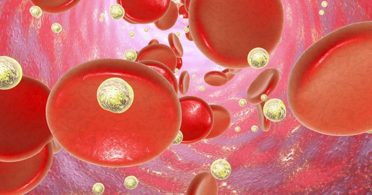 In Sickle Cell Disease, White Blood Cells Regulate Fetal Hemoglobin